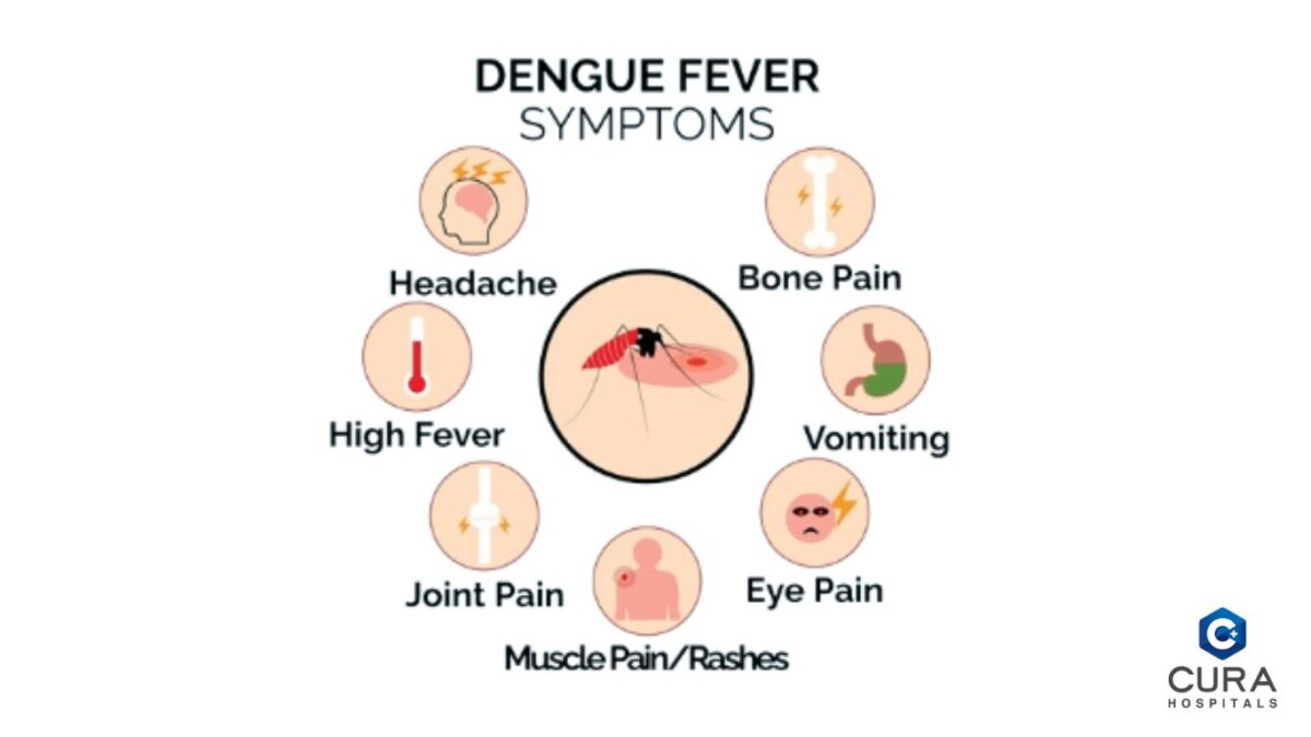 Dengue Fever Symptoms, Treatment, and Prevention Tips Cura Hospitals